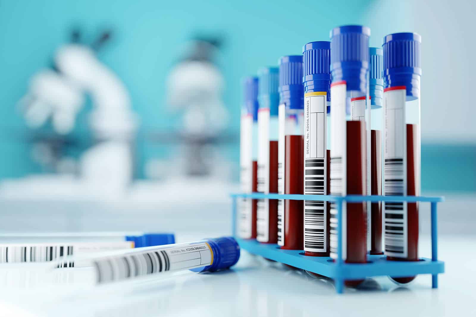 Does DMT show up on a Drug Test? - Long Island Treatment Center