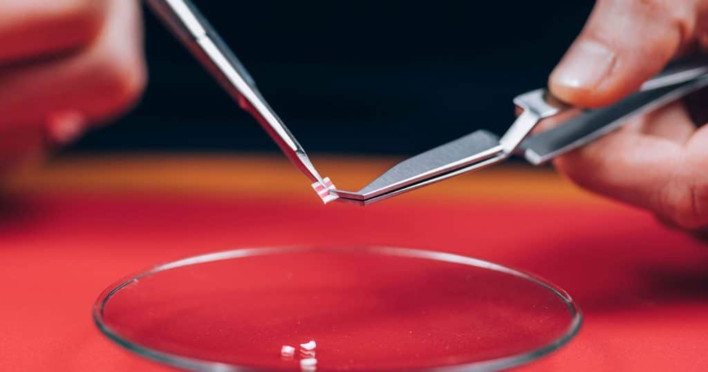 Does LSD Stay in the Spinal Fluid? - Long Island Treatment Center