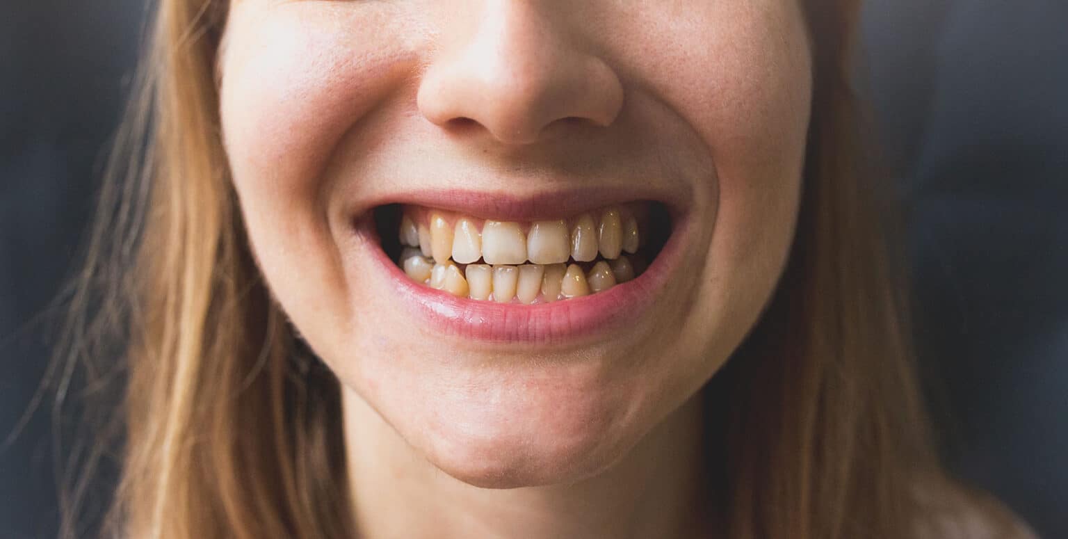 Coke Jaw, Mouth, and Nose: Dangerous Side Effects of Cocaine Use - Long ...