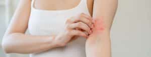 Why Does Meth Make You Itch? Understanding Meth Mites and Skin ...